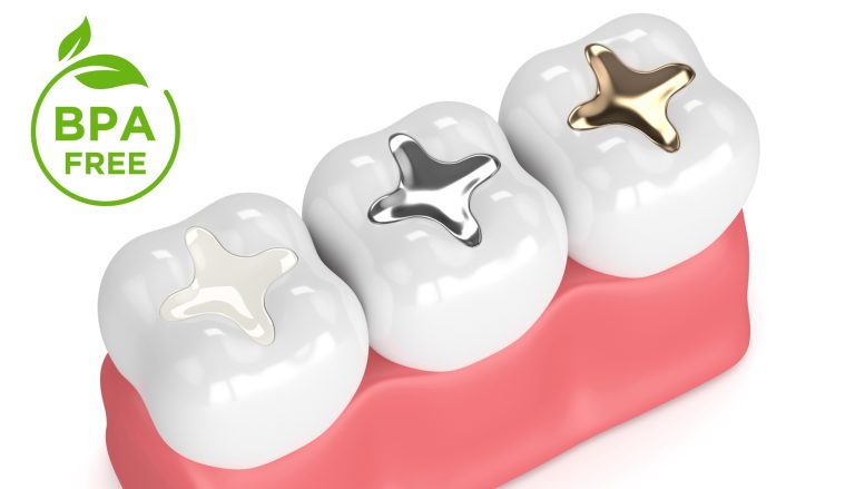 BPA-Free Dental Materials: What You Need to Know